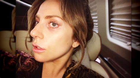 Lady Gaga Normal No Makeup