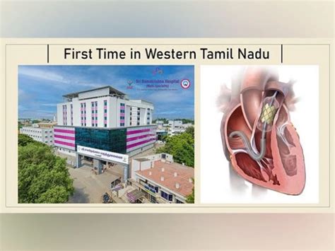 Business News Sri Ramakrishna Hospital Introduces Groundbreaking Tpvr