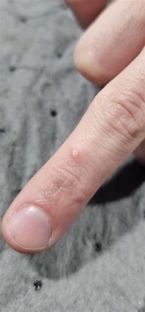 Help Identifying Scrolller