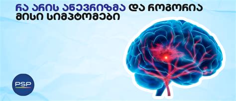 რა არის ანევრიზმა და როგორია მისი სიმპტომები