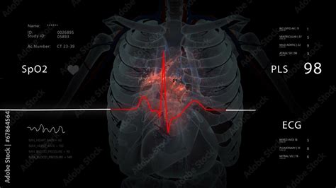 Heart Rate Monitor Mri X Ray Ct Scan Futuristic Technological Interface Medical Hud Monitoring