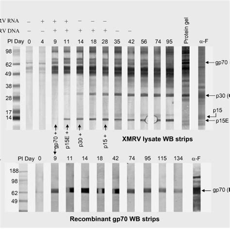 Xmrv Viral Proteins A Xmrv Viral Proteins Identified By Wb Analysis