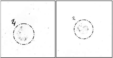 Typical Cu Bullet Wipes Gsr Patterns On The Borders Of The Hole On