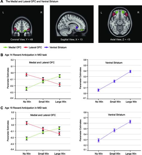 Medial Orbitofrontal Cortex OFC Lateral OFC And Ventral Striatum Download Scientific