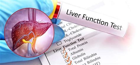 Lft Blood Test A Comprehensive Guide