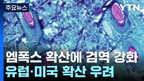 유럽·미국 확산 시 국내도 위험엠폭스 검역 강화 Ytn Youtube