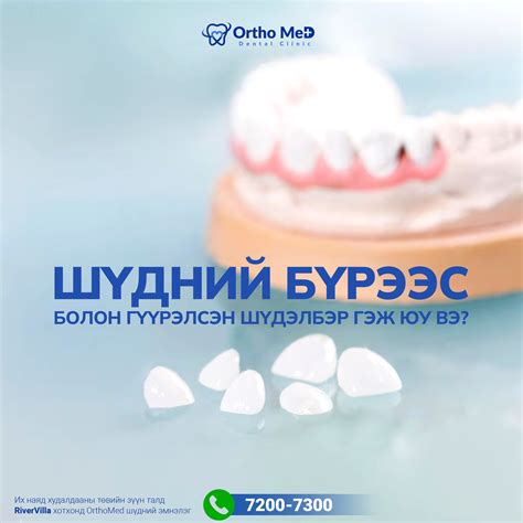 Orthomed 1 шүдийг бүхэлд нь засаад циркон шаазангаар бүрснийг Бүрээс