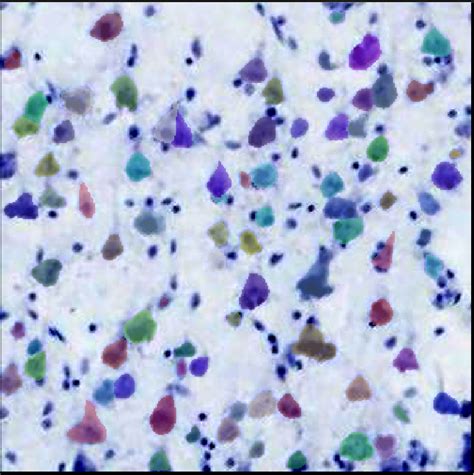 Automatic Cellpose 2 2 Segmentation Of Neurons In Human Neocortex