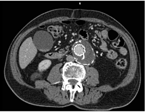 Sage Business Cases Body Scans And Bottlenecks Optimizing Hospital Ct Process Flows