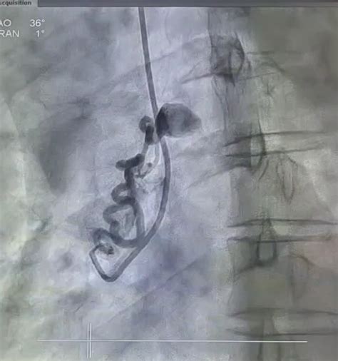 Aster Shaik Masood Mohiddin