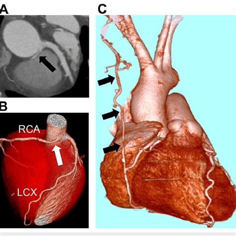A Two And B Three Dimensionally Enhanced Computed Tomography Scan Download Scientific