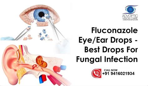 Fluconazole Eye Ear Drops Best Drops For Fungal Infection