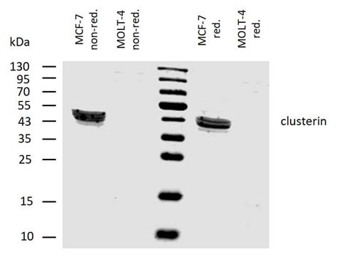 Clusterin Apoj Antibody Hs 3 Bsa Free Nb500 552 Novus Biologicals