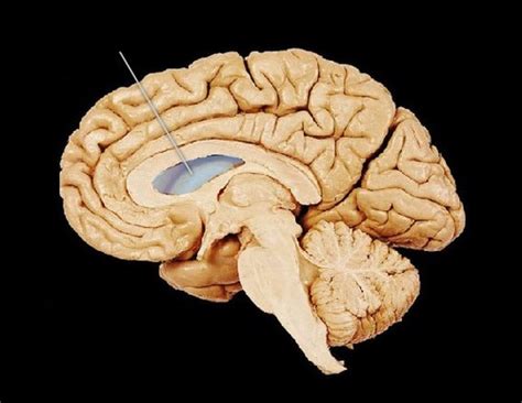 Exam 4 Ventricles Flashcards Quizlet
