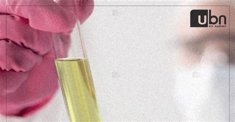 Шээсний уургийн электрофорез болон иммунотайпинг шинжилгээний 70 хувийг