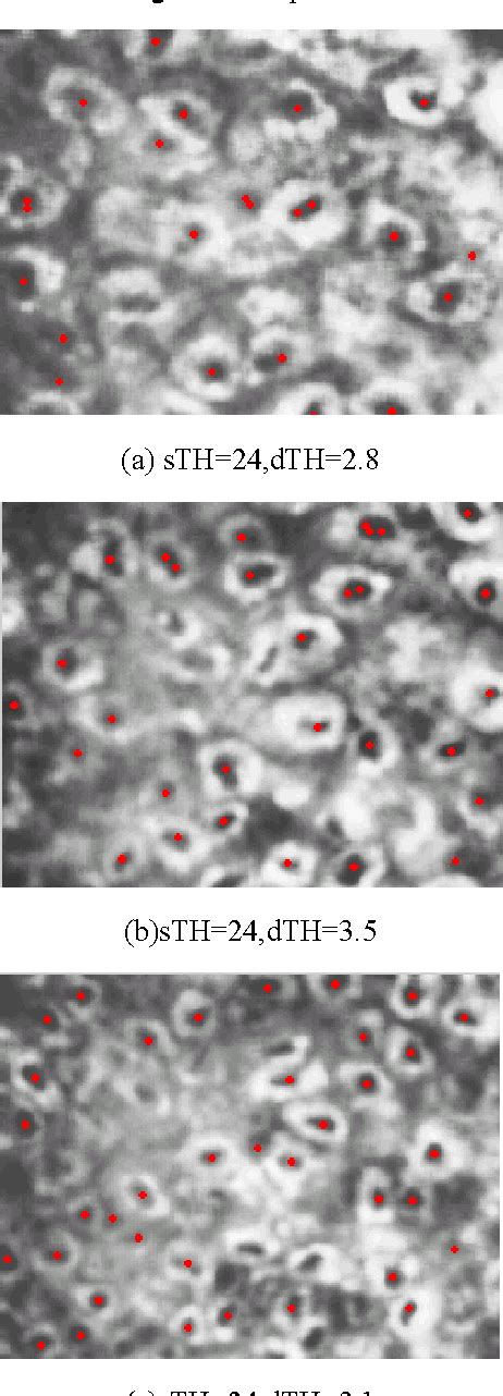 Figure 3 From A New Center Location Algorithm Used In Cell Segmentation