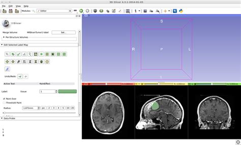 Documentation Nightly Extensions CarreraSliceInteractiveSegmenter Slicer Wiki