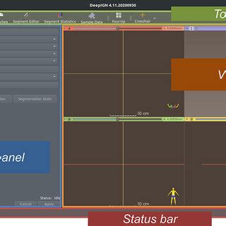 Use Case Diagram Of The Proposed AI4Neurosurgery Application To Download Scientific Diagram