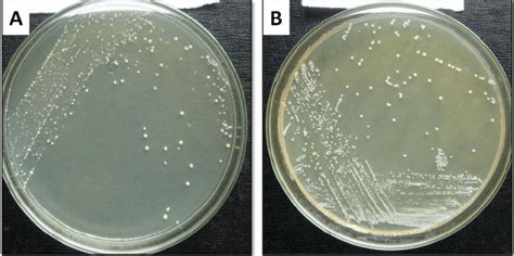 Lactobacillus Spp Lactobacillussppg 77