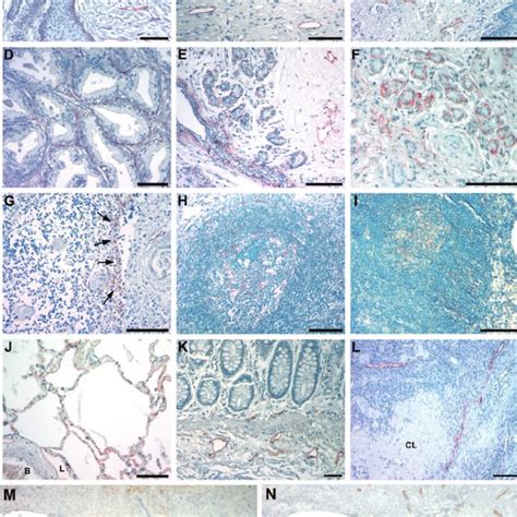 Podoplanin Expression In Normal Mouse Tissues Immunohistochemical Download Scientific Diagram
