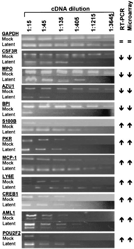 Validation Of Microarray Data With Semiquantitative Dilu Tion Rt Pcr
