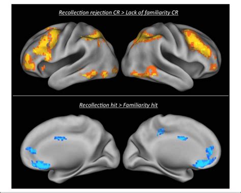 Neural Activity Associated With Recollection Rejection Top And Target