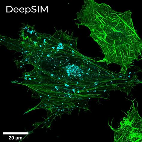 Breaking The Diffraction Limit Discovering Cellular Organelles With