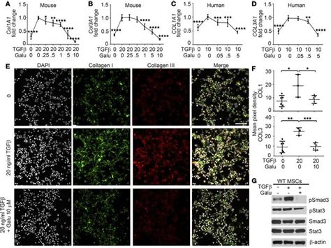 JCI Insight Efficacy Of ALK Inhibition In Myelofibrosis