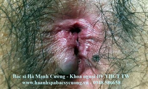 Tri U Ch Ng Ch N O N Ti N S B C S H M Nh C Ng