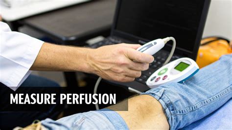 Definition Tissue Perfusion Understanding Its Importance Pycad