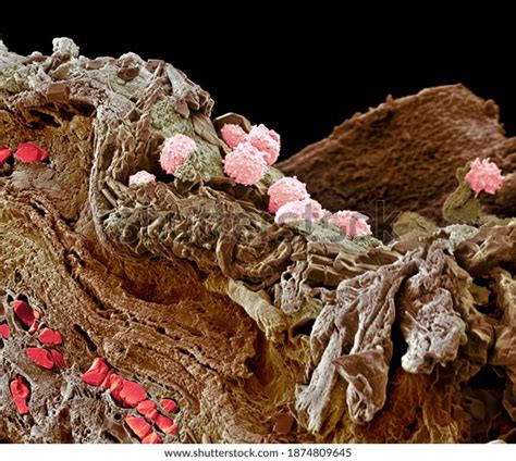 Pyoderma Skin Disease Under Color Scanning Stock Illustration 1874809645 Shutterstock