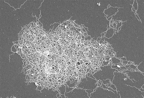 Free Picture Closer Organisms Borrelia Burgdorferi Bacteria