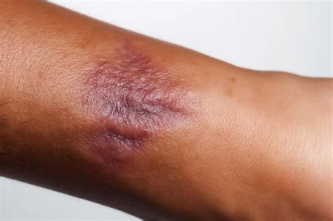 Premium Ai Image Visualizing Skin Conditions A Medical Illustration