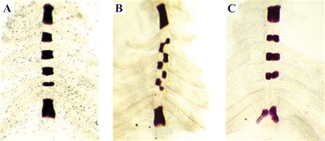 Skeletal Abnormalities Of The Sternebrae And Xiphoid Process A Skeletal Abnormalities Of The Sternebrae And Xiphoid Process A
