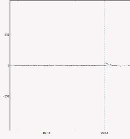 2 2 Typical Example Of The Different Stages Identified With Visual Download Scientific Diagram