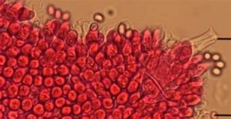 Systé Tps questions Flashcards Quizlet