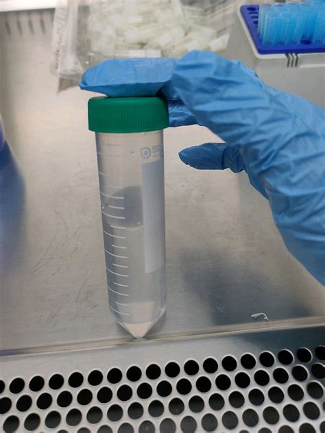 Sharjana Akter On Linkedin Preservation Of The Burkholdrria Glumae In 30 Glycerol And Storing