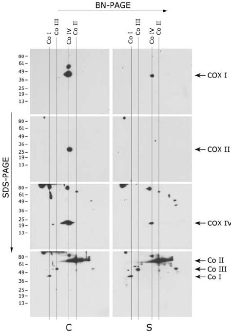 Cox Assembly Defect In Patient S Fibroblasts Mitoplasts 20 M G Download Scientific Diagram