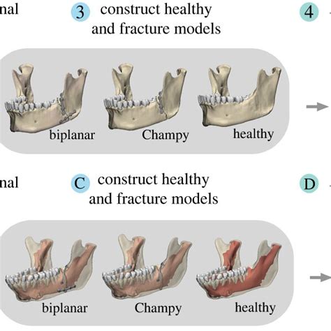 Flow Chart Of Finite Element Analysis Fea For Human Models 1 5 And Download Scientific