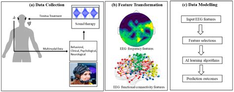 Prediction Of Tinnitus Treatment Outcomes Based On Eeg Sensors And Tfi