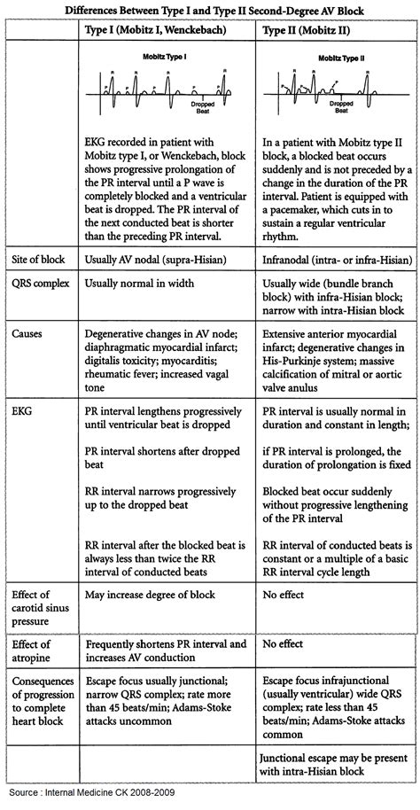 Conduction Blocks At The Av Node Av Blocks [with Examples] Manual Of Medicine