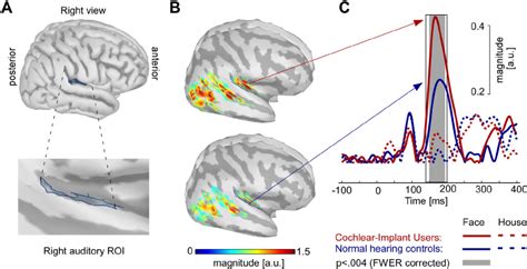 Source Analysis Of The N170 Component In The Auditory Roi A Top Download Scientific Diagram