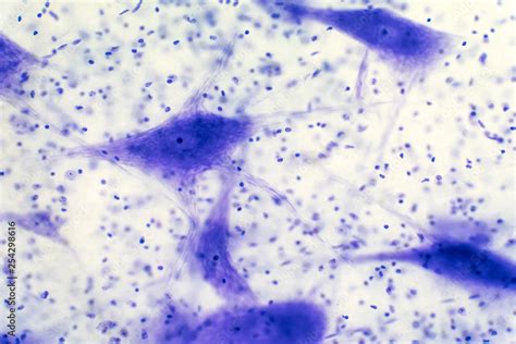 Giant Multipolar Neuron Slide