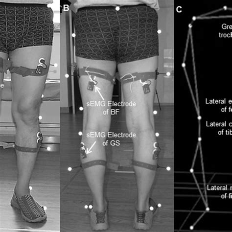 Pdf Associations Between Lower Limb Muscle Activation And Knee Flexion In Post Stroke