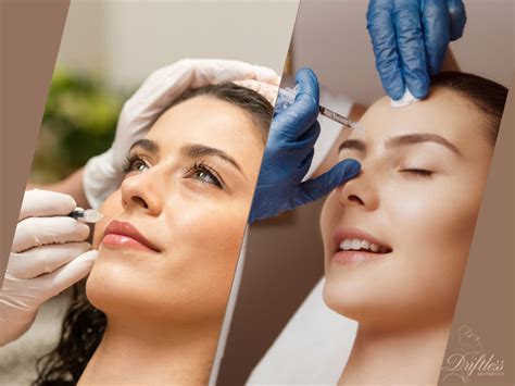 Botox Results Week By Week Complete Timeline And What To Expect