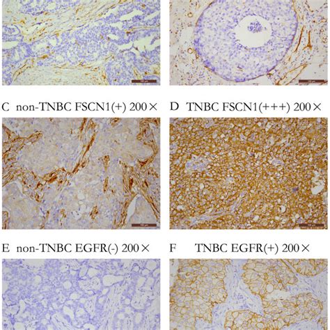 Correlation Analysis Of The Tcga Breast Invasive Carcinoma Database