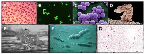What Is Bacteria Types Structure Shapes Morphology