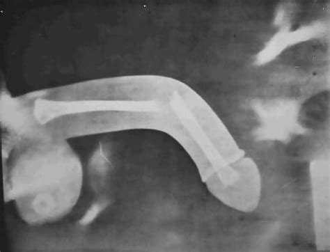 Dibujos Animados Fotos Porno Xxx Fotos Imágenes De Sexo 1450252 Pictoa