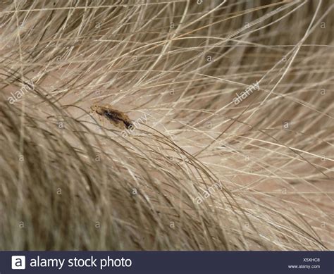 Pediculus Capitis Stockfotos Und Bilder Kaufen Alamy