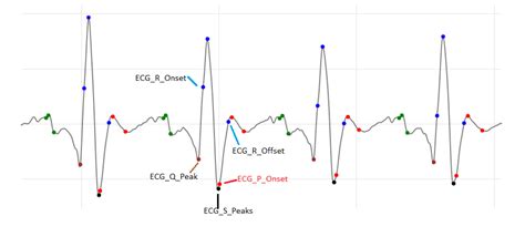 Incorrect Edges Of Peak Waves · Issue 761 · Neuropsychologyneurokit · Github
